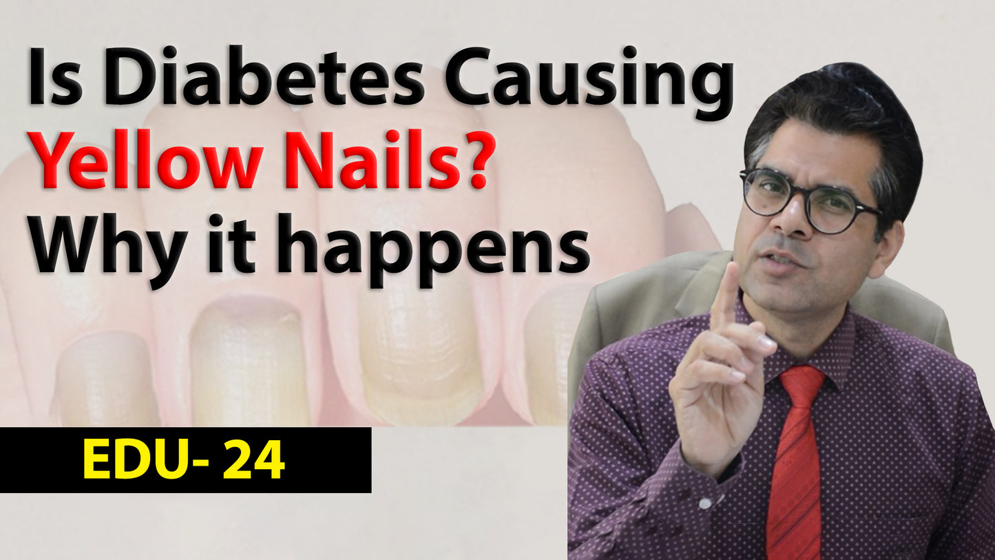 Education – Diabexy